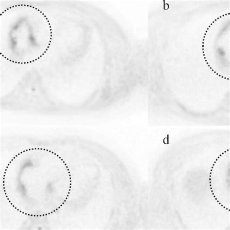 Diffusion Weighted Whole Body Magnetic Resonance Imaging With Download Scientific Diagram