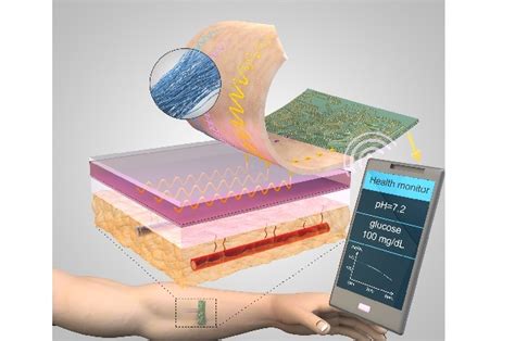 Smart Sutures Send Wireless Status Reports From Wound Sites SP Robotic Works
