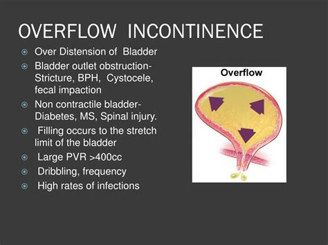 Overflow Incontinence Cholinergic Agonist At Maria Couch Blog