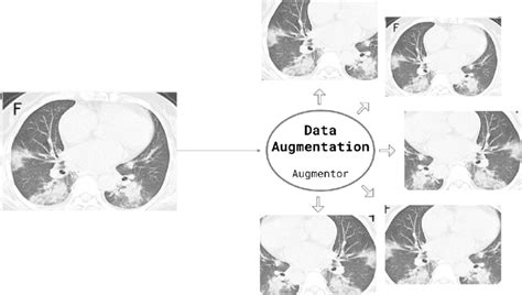 Data Augmentation Applied Using The Augmentor Python Package The
