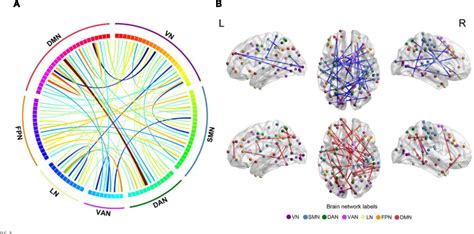 Table 1 From Altered Intrinsic Functional Brain Architecture In Patients With Functional
