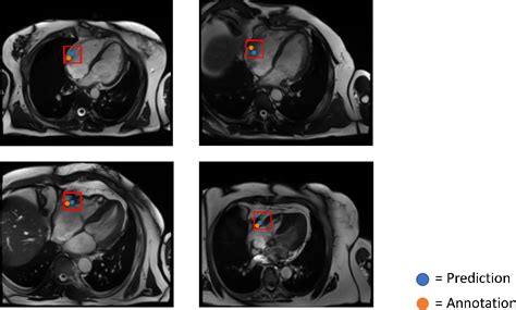 Figure 1 From Automated Cardiac Resting Phase Detection Targeted On The