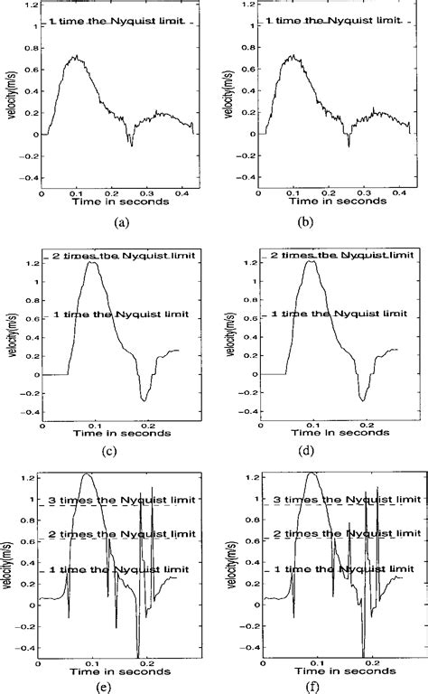 Figure 8 From An Extended Autocorrelation Method For Estimation Of