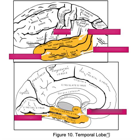 Temporal Lobe Diagram Quizlet