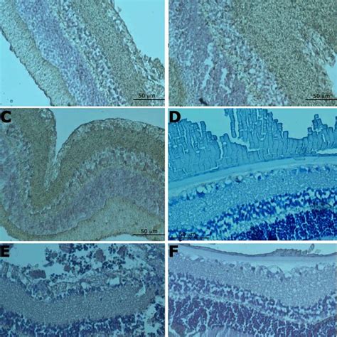 A Control Group Regular Distribution Of E Cadherin Expression In The