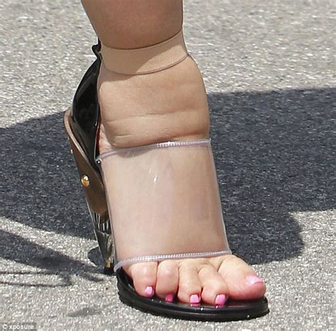 Shoes For Fat Swollen Feet At Frank Keith Blog