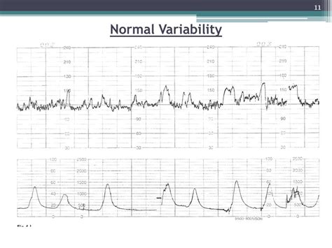 Ppt Calibration Of The Ctg Powerpoint Presentation Free Download Id 2534045