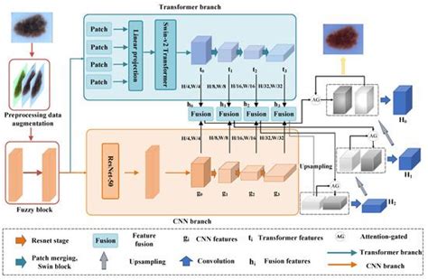 Segmentation Medicalimage Fuzzylogic Cnn Swintransformer Applied