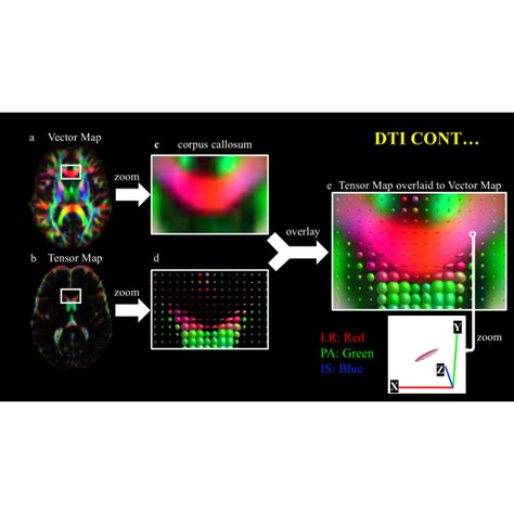Figure Explaining Diffusion Tensor A Vector Map B Tensor Map Were Download Scientific