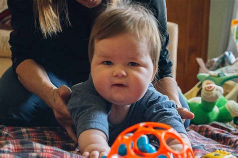 The Everett Day Life Our Prader Willi Syndrome Story Growing