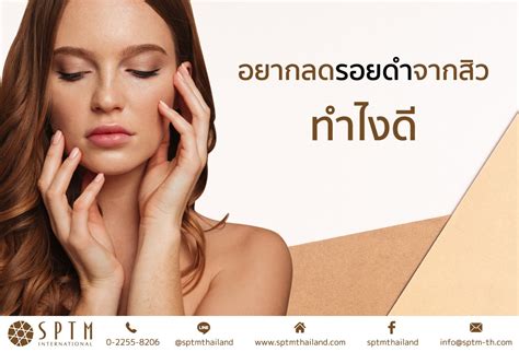🧐 อยากลดรอยดำจากสิวทำไงดี Sptm International Facebook