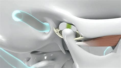 Posterior Disc Displacement In Tmj Disorder Smiles By Bis