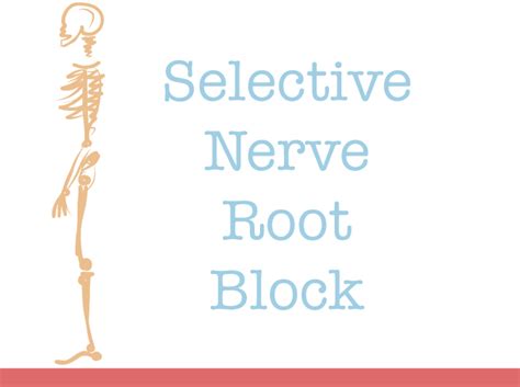 Selective Nerve Root Block Complex Pain And Wellness Selective Nerve Root Block Complex Pain And Wellness