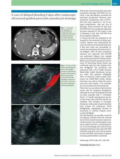 Pdf A Case Of Delayed Bleeding 9 Days After Endoscopic Ultrasound Guided Pancreatic Pseudocyst