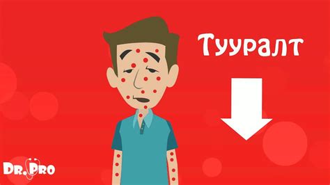 Улаан бурхан өвчнөөс сэргийлье