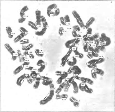 Photograph Of A Human Metaphase Spread With The Location Of The Download Scientific Diagram