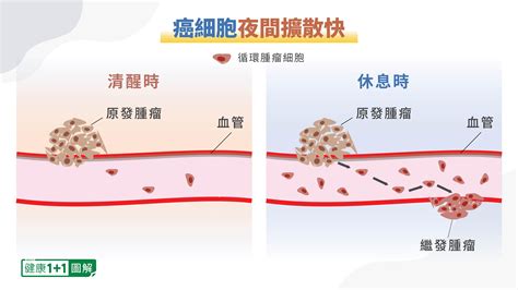 在人休息時癌症醒來和擴散 癌細胞 癌症擴散 乳腺癌 大紀元