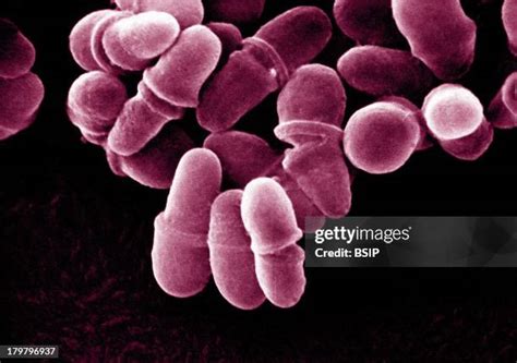 Malassezia Photos And Premium High Res Pictures Getty Images