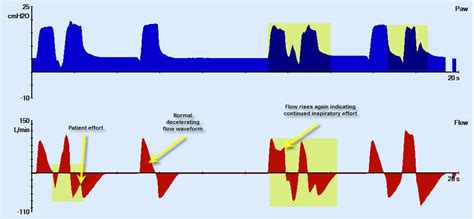 K Scott Richey Waveform Of The Week Double Triggering
