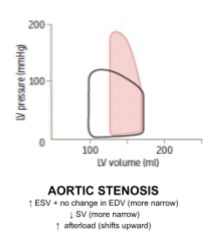 Cardiac Cycle Heart Sounds PV Loop Pathologies Flashcards Quizlet