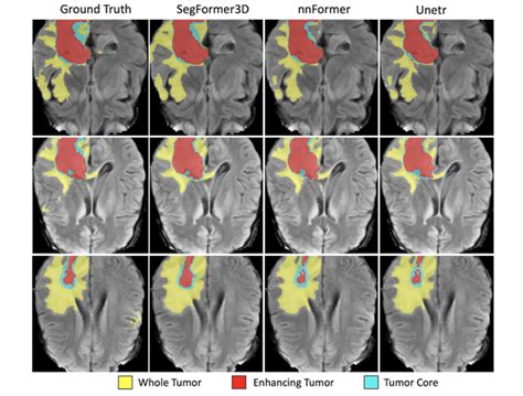 Segformer3d An Efficient Transformer For 3d Medical Image Segmentation