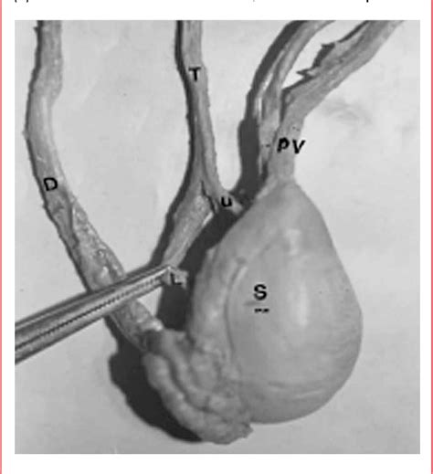 Structure Of Inferior Vesical Artery Semantic Scholar