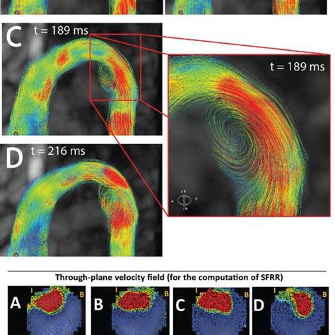 Flow Field Visualization Top Visualization Of The Velocity Field As A