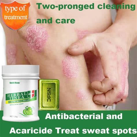 【removal Of Ringworm And Sweat Spot Set】 Anti Mite Anti Bacterial And Anti Itching Plant Soap