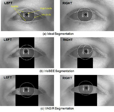 Comparison Of A Ideal Segmentation B Irisbees Approach And C