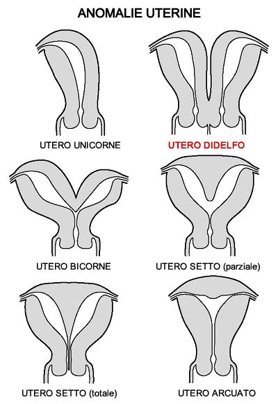 Utero Didelfo Epos™