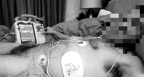 My First Defib Shock Through The Heart