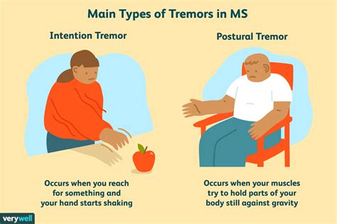 What Causes Tremors In Your Hands And Legs At Scott Cahill Blog