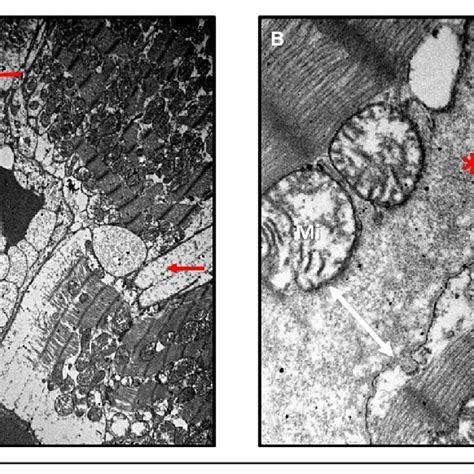 Interstitial And Cytoplasmic Edema After Irradiation A Rat Left