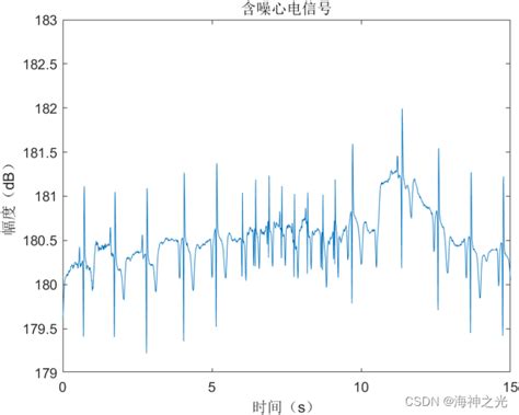 【心电信号 】ecg心电信号qrs波群特征提取【含matlab源码 3385期】 差分法提取qrs波 csdn博客