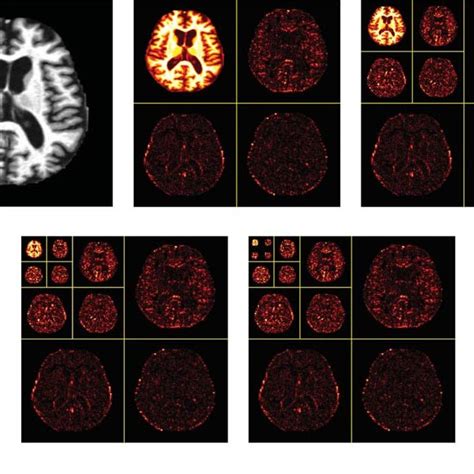 Wavelet Decompositions A Raw Image B Level 1 Decomposition C Download Scientific Diagram