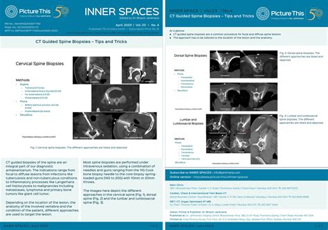 Inner Spaces Ct Guided Spine Picture This By Jankharia