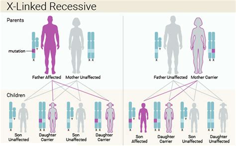 Lesch Nyhan Syndrome Causes Symptoms Treatment And Life Expectancy