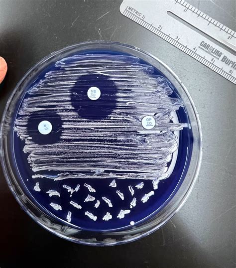 Identify The Unknown Bacteria From These Bacterias Bacillus Cereus Bacillus Subtilis