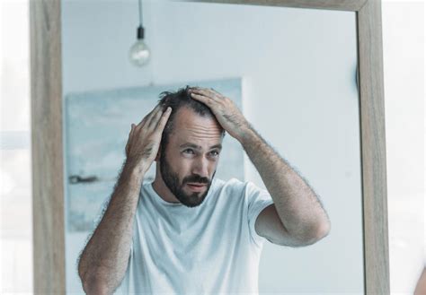 The Stages Of Balding And Treatment Options Aventus Clinic