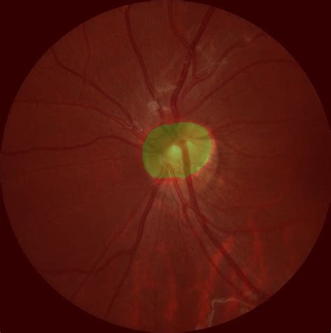 图像分割效果随图片size变化周期性地产生偏移的问题 · Issue 3385 · Paddlepaddlepaddleseg · Github