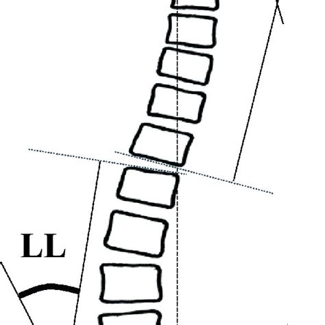 Radiographic Measurements Of The Spinal Sagittal Parameters Thoracic Download Scientific