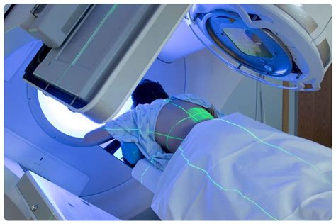 External Rectal Cancer Pictures