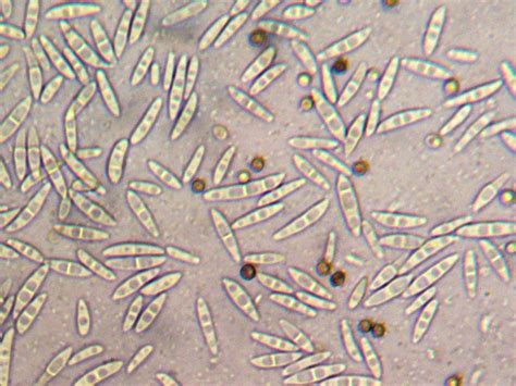 Fusarium Mold