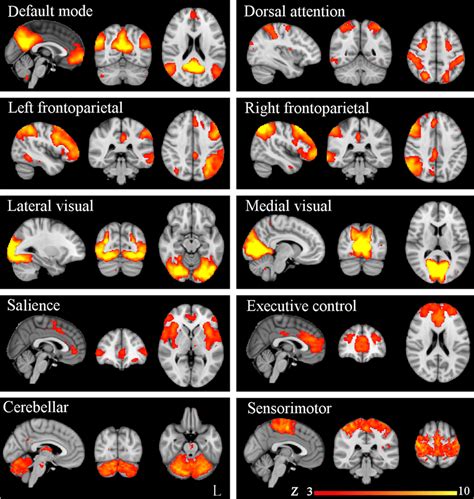 Resting State Networks Rsns Identified And Used For Dual Regression Download Scientific