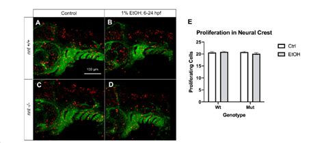 Proliferation Is Not Significantly Altered In Neural Crest Of Nnt