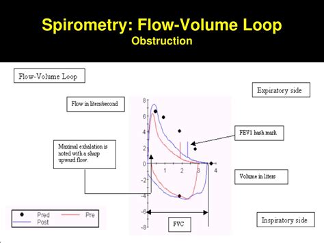Spirometry Loops At Billy Curnutt Blog