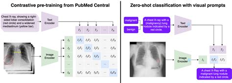 논문 리뷰 Visual Prompt Engineering for Vision Language Models in Radiology