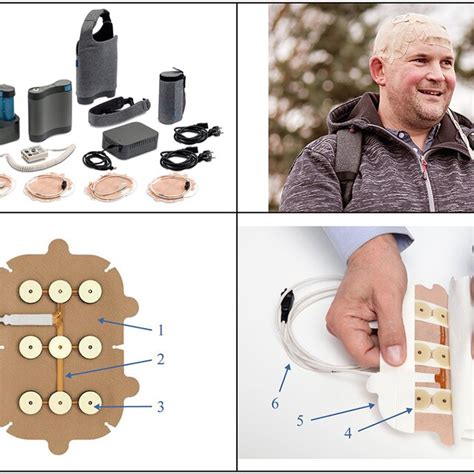 The Tumor Treating Fields Ttfields Device And Transducer Arrays Top