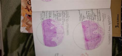 Solution Leukoplakia Histology Diagram Studypool