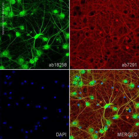 Anti Psd95 Antibody Synaptic Marker Ab18258 Abcam